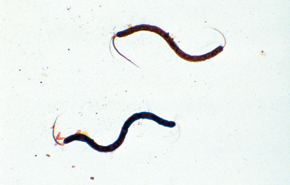 Faulwasserbakterien (Spirillen) 4542e | LMS Lehrmittel-Service H.Späth GmbH