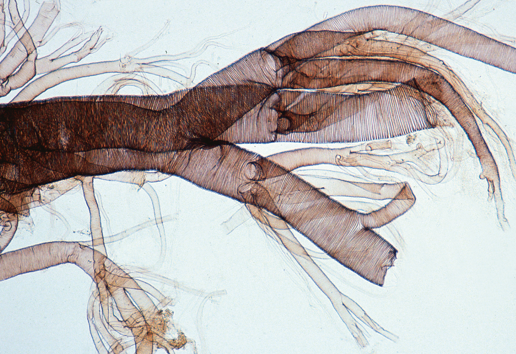 Tracheen vom Insekt. Verzweigte Atemröhren | LMS Lehrmittel-Service H ...