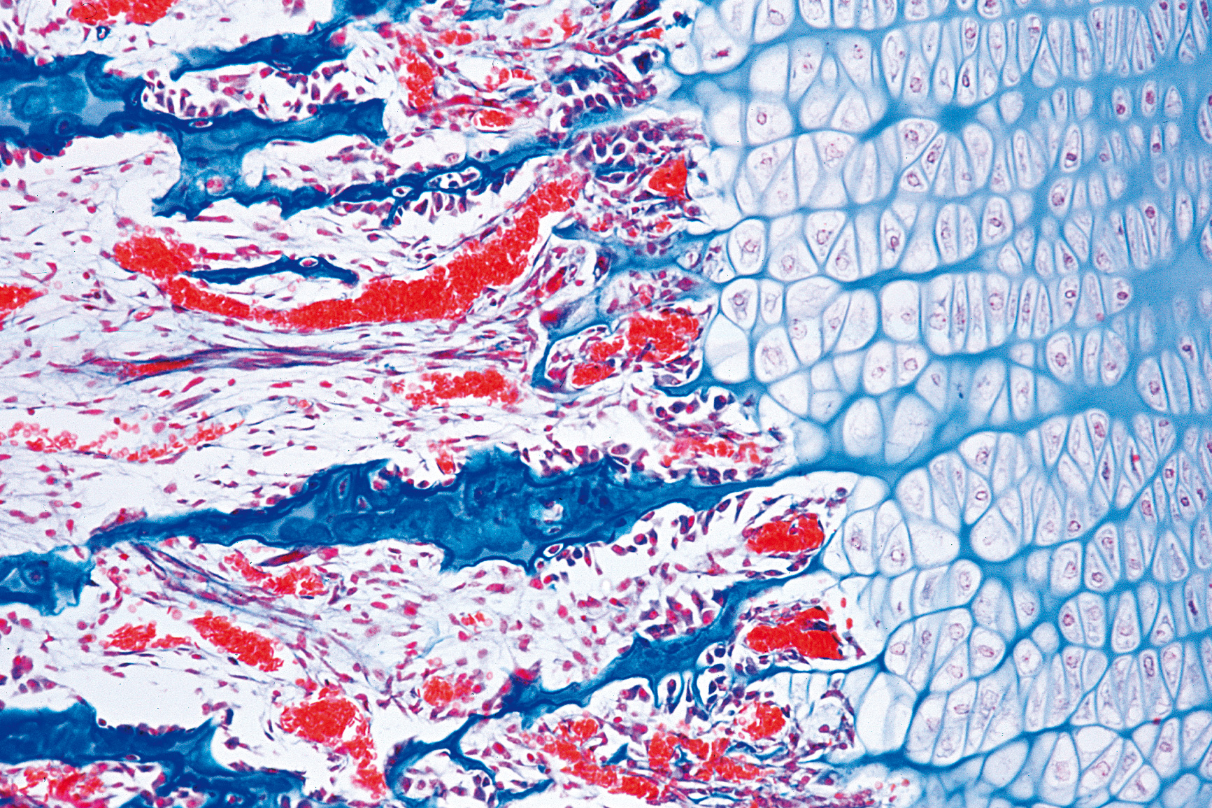 Knochenentwicklung Ma138e | LMS Lehrmittel-Service H.Späth GmbH