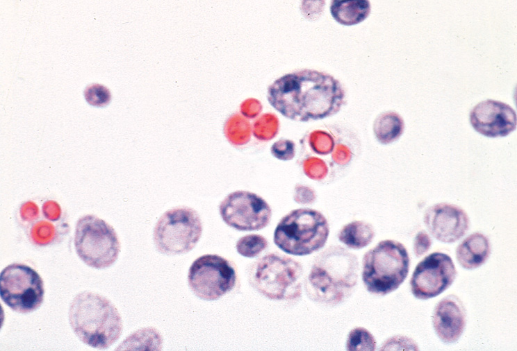 Saccharomyces cerevisiae, Hefepilze, Zellen in Sprossung | LMS ...