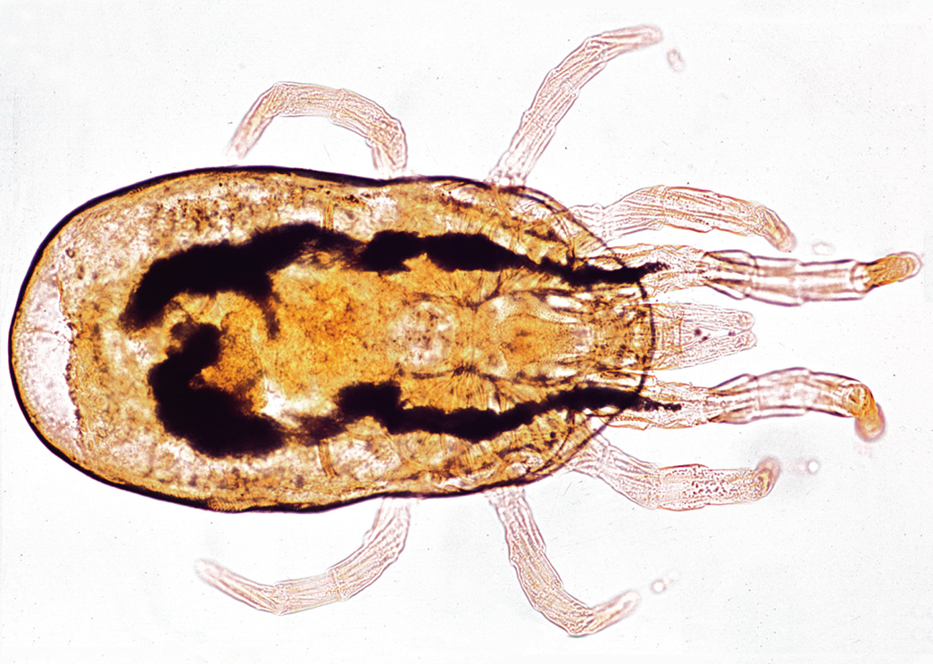 Dermanyssus gallinae, Hühnermilbe, Totalpräparat | LMS Lehrmittel ...