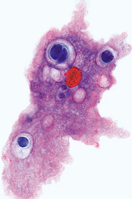 Protozoen (Einzeller) Lehrerpaket SMD-02 | LMS Lehrmittel-Service H ...