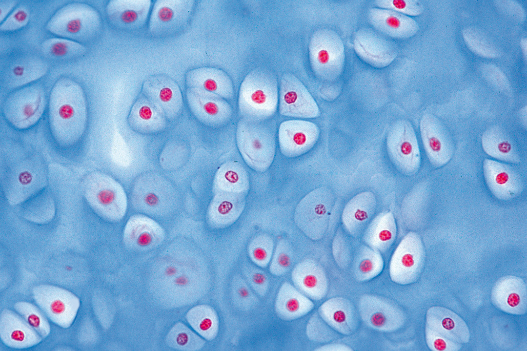 Hyaliner Knorpel v.Säugetier, quer. Knorpelzellen | LMS Lehrmittel ...