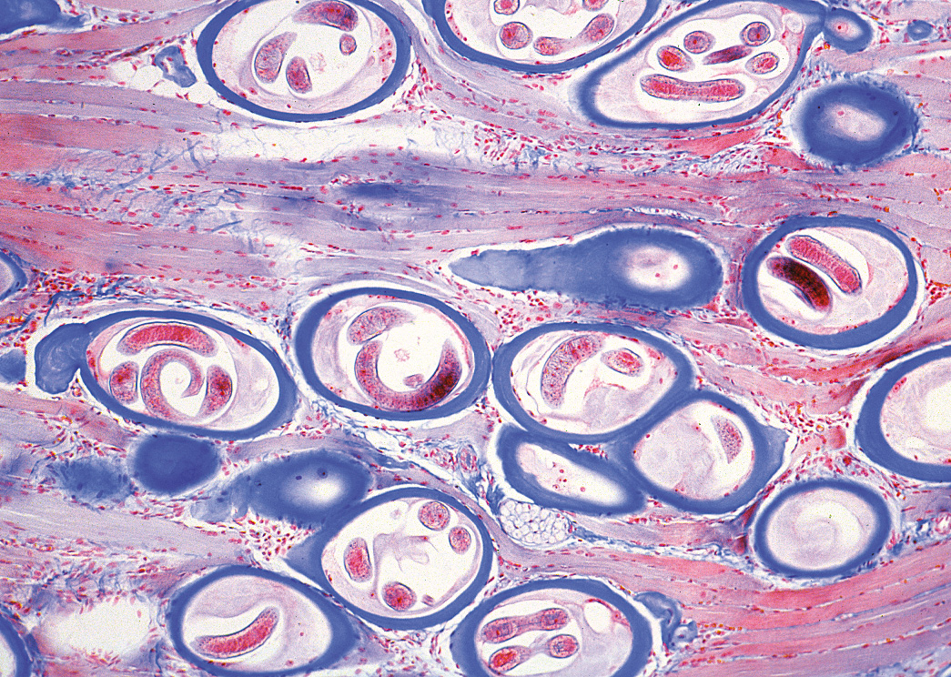Anatomia Da Triquinela Espiralis