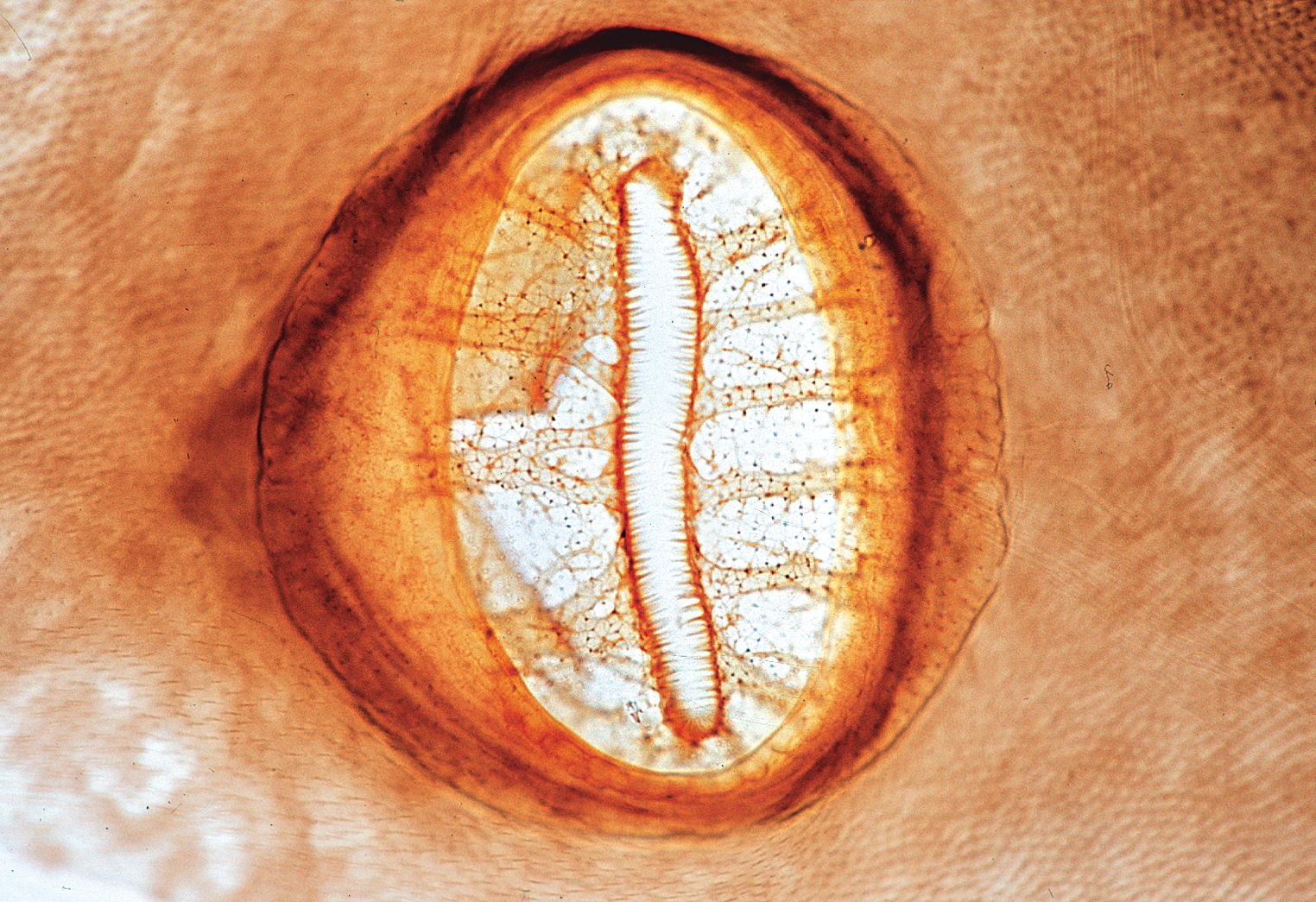 Stigma vom Insekt. Atemöffnungen der Insekten | LMS Lehrmittel-Service ...