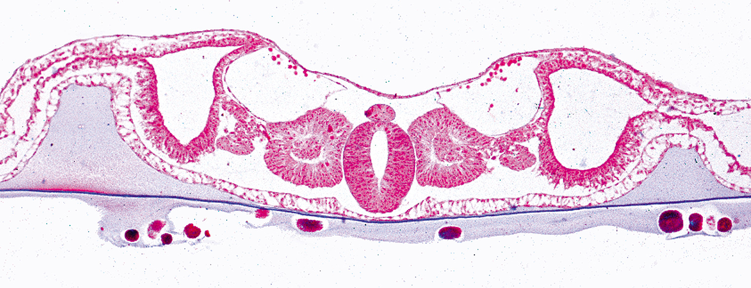 Embryo v.Huhn, 48 Stunden alt, quer. Neuralrohr und Chorda... | LMS ...